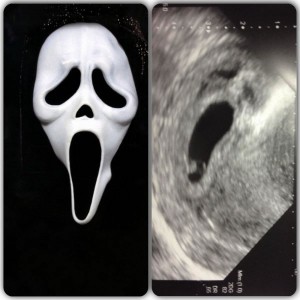 12 Creepy and Disturbing Baby Ultrasounds - Riot Daily